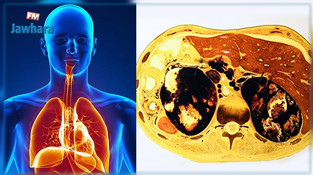Découverte d'un nouvel organe dans le corps humain